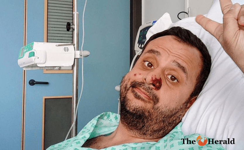 Mpox: A person infected with the lethal variant discovered in Sweden, a ...